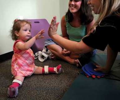 » Arthrogryposis Multiplex Congenita – Pictures, Treatment, Causes